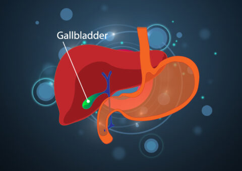 Gallbladder Removal | Go Light Bariatrics